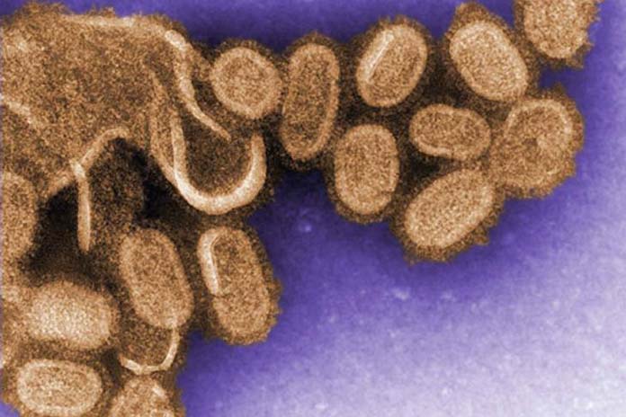 H7N9 flu mutation identified that allows immune system escape ...